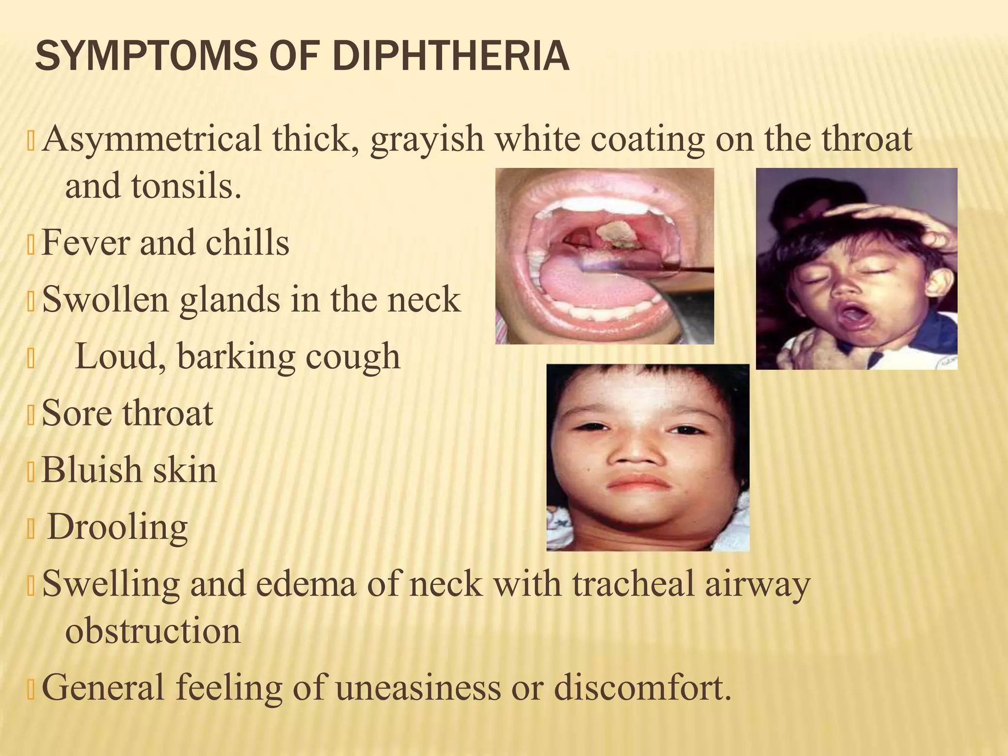 Diphtheria.pptx