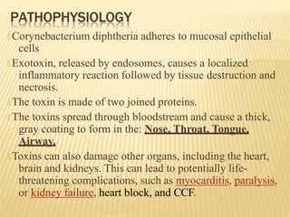 Diphtheria.pptx