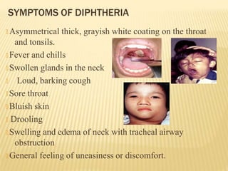 Diphtheria.pptx