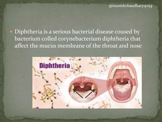 DIPHTHERIA by Manish Kumar diphtheria ppt | PPT
