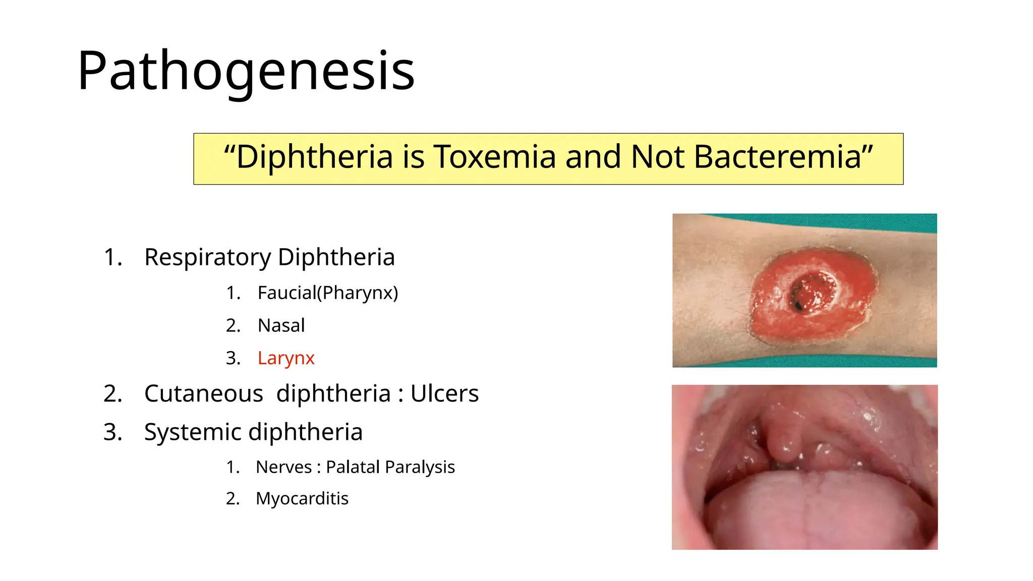 Corynebacterium diphtheriae : Essentials for MBBS Microbiology | PPTX