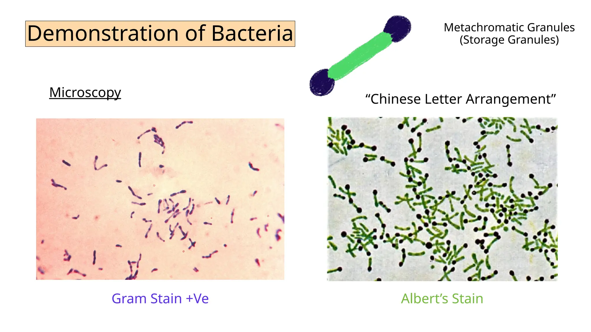 Corynebacterium diphtheriae : Essentials for MBBS Microbiology | PPTX