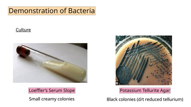Corynebacterium diphtheriae : Essentials for MBBS Microbiology | PPTX