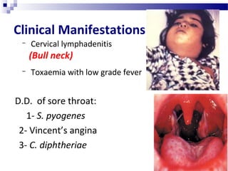 Diphtheria - Prac. Microbiology | PPT