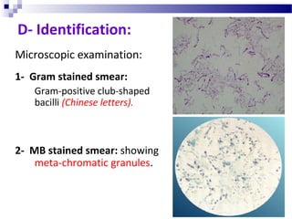 Diphtheria - Prac. Microbiology | PPT