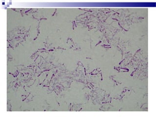 Diphtheria - Prac. Microbiology | PPT