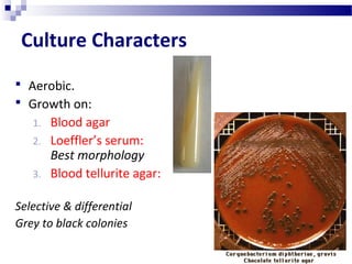 Diphtheria - Prac. Microbiology | PPT