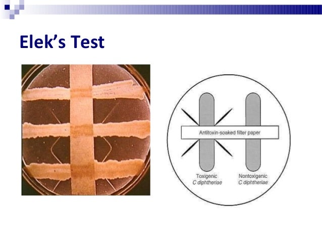 Diphtheria - Prac. Microbiology