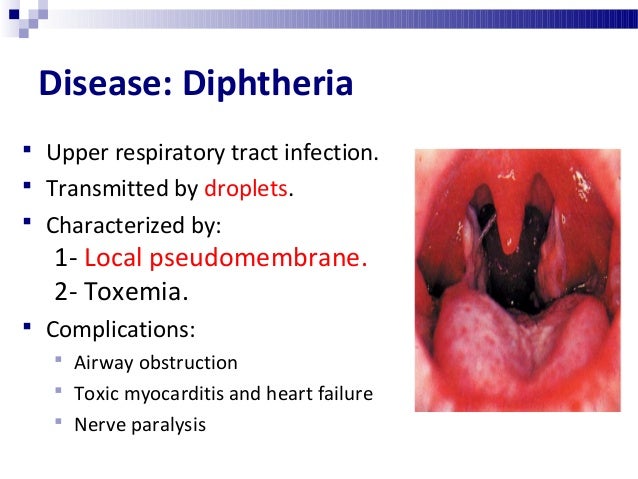 Diphtheria - Prac. Microbiology