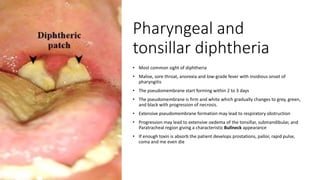 Diphtheria by Dr.Prudhvi Kilaru.pptx