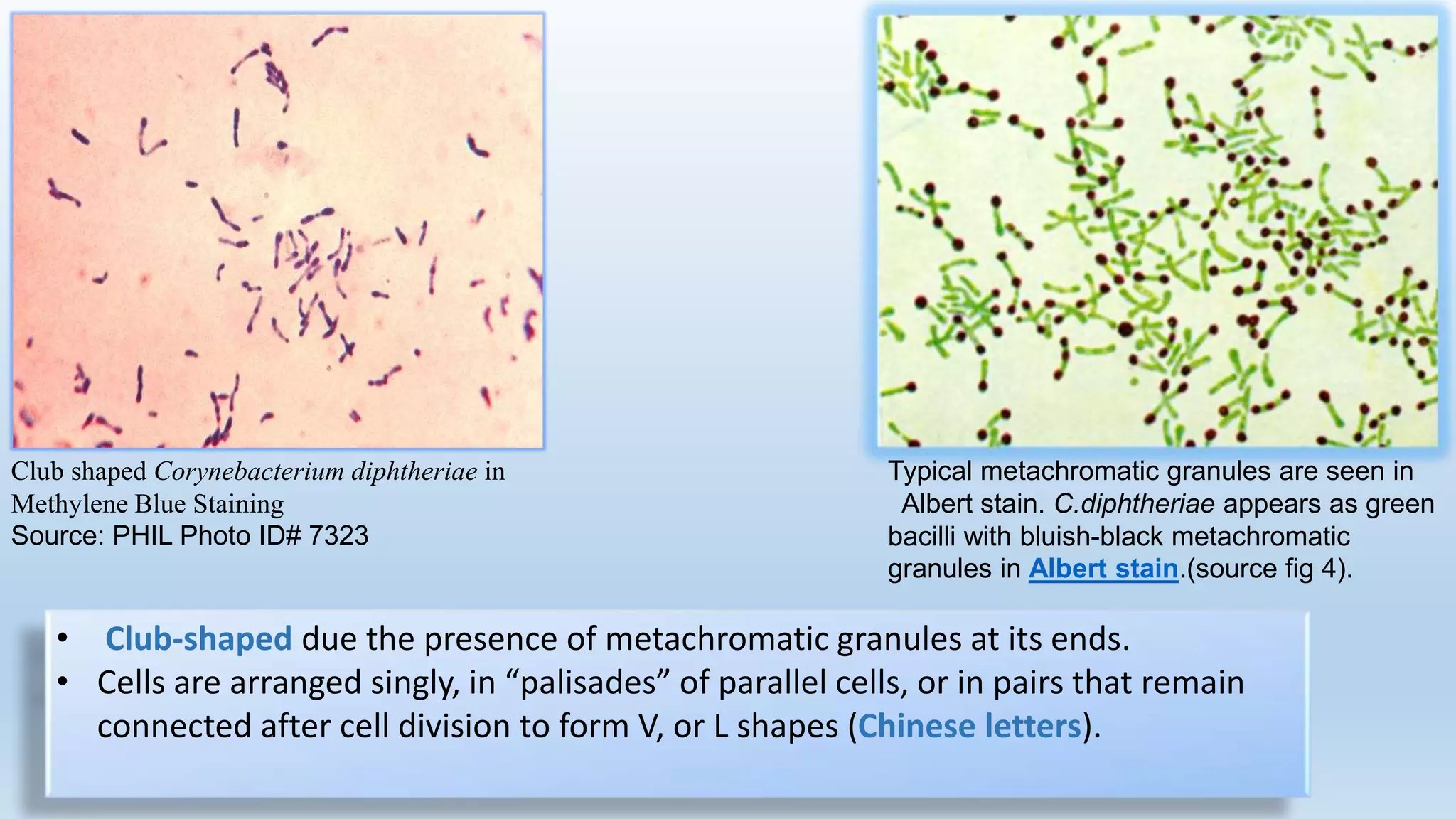 Diphtheria microbiology presentation . | PPTX