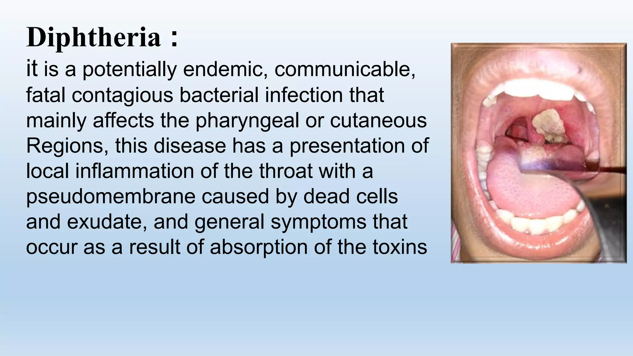 Diphtheria microbiology presentation . | PPTX