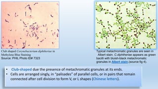 Diphtheria microbiology presentation . | PPTX