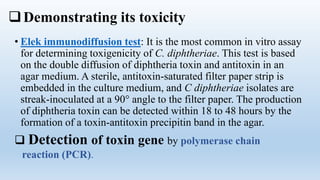 Diphtheria microbiology presentation . | PPTX