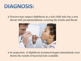 Diphtheria ppt | PPTX