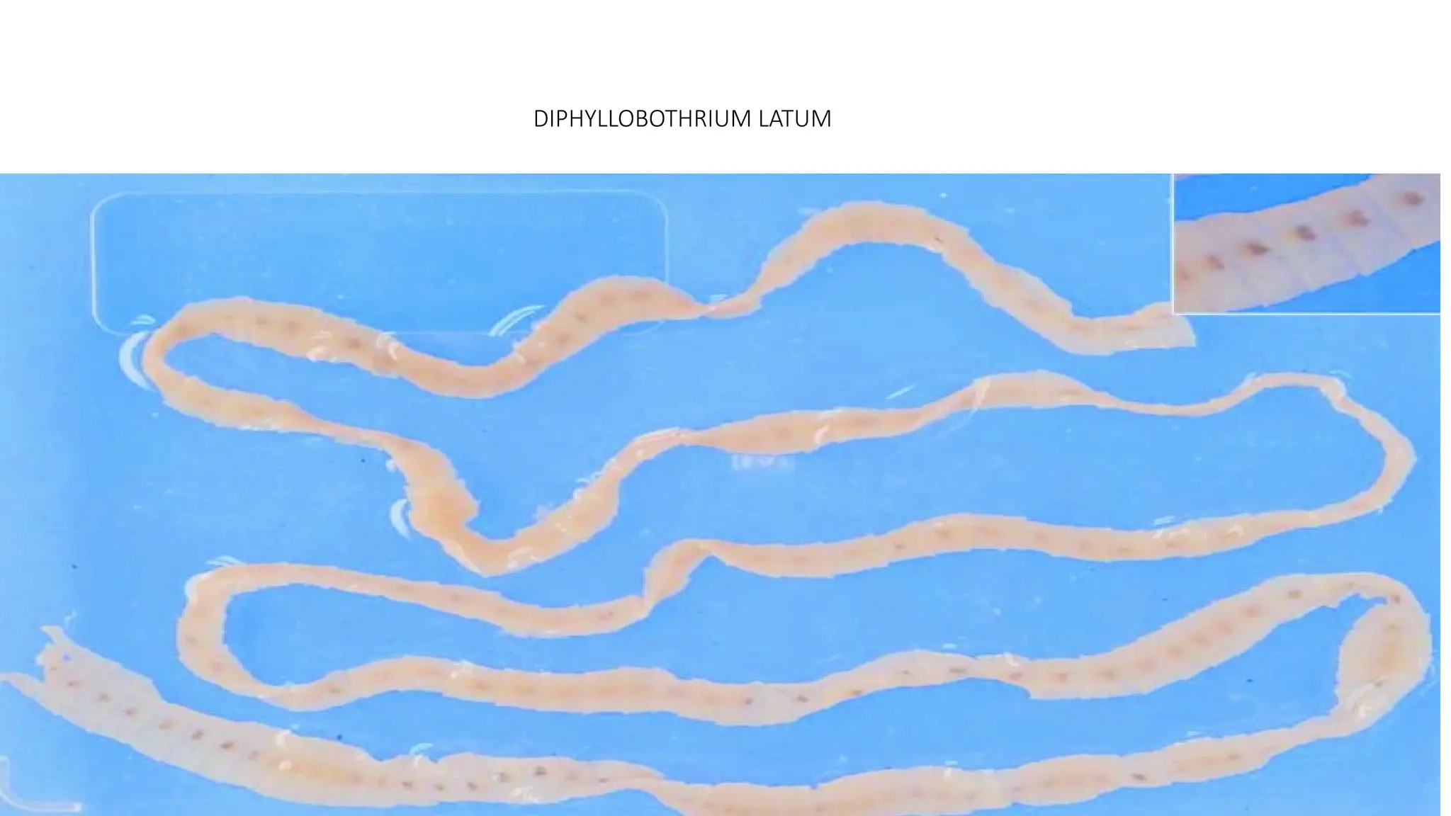 DIPHYLLOBOTHRIUM LATUM.pptx. . | PPTX