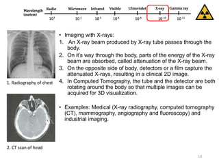 Introduction to Medical Imaging | PPTX