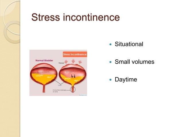 Urinary incontinence management | PPT | Digestive Disorders | Diseases ...
