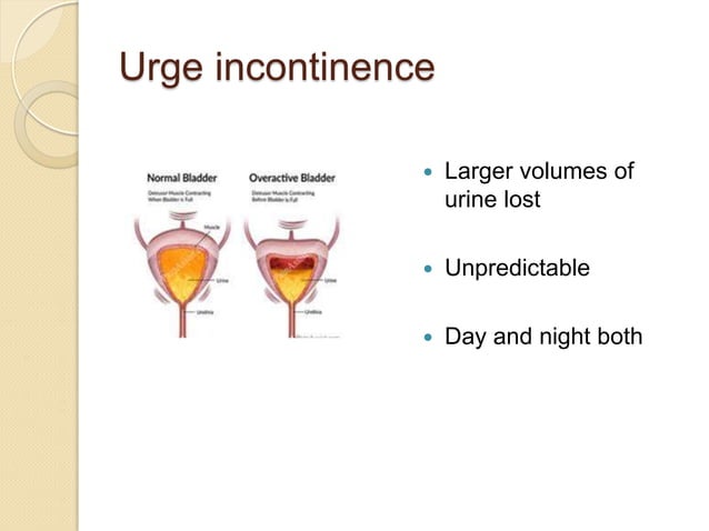 Urinary incontinence management | PPT | Digestive Disorders | Diseases ...