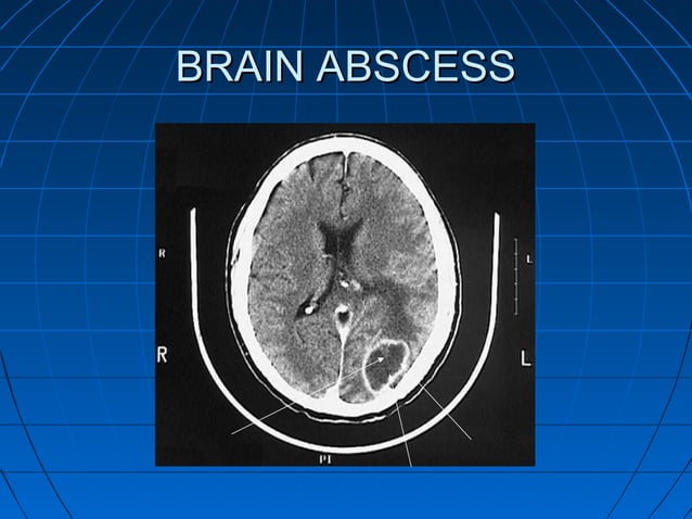 coma | PPT | Brain and Nervous System Disorders | Diseases and Conditions