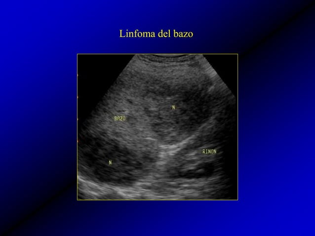 ecografia de bazo (esplenica) | PPT