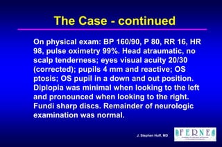 Diplopia | PPS