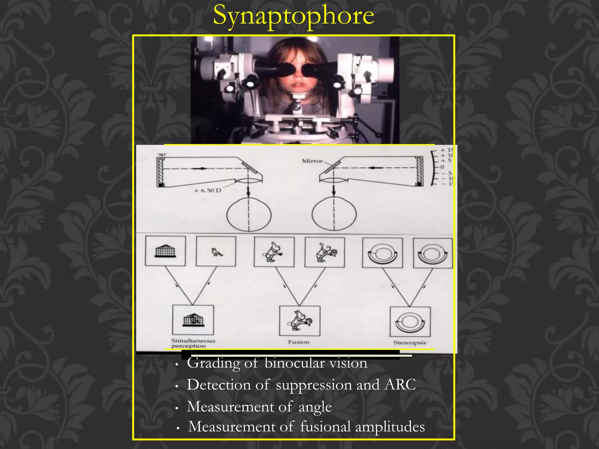 Diplopia | PPTX