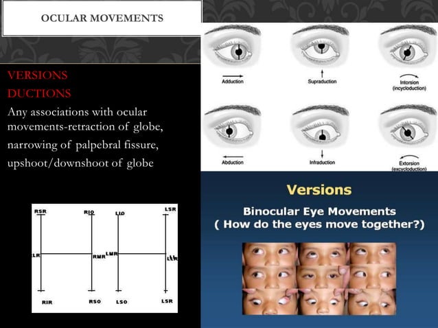 Diplopia | PPTX | Eye and Vision Conditions | Diseases and Conditions