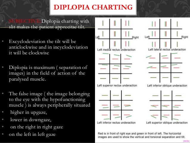 Diplopia