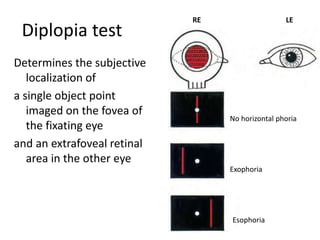 Diplopia | PPT