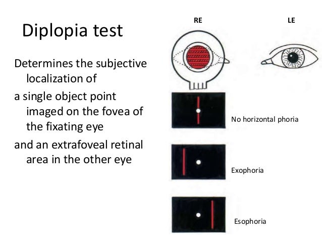 Diplopia