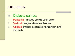 Diplopia 1 | PPT