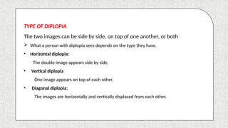 abc diplopia lecture aaaaaaaaaaaaaaaaaaaaaaaaaaaaaaaaaaaaaaa | PPT