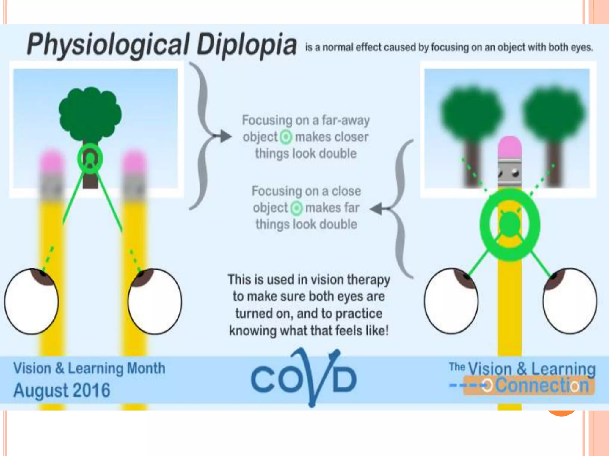 Diplopia approach | PPTX | Eye and Vision Conditions | Diseases and Conditions