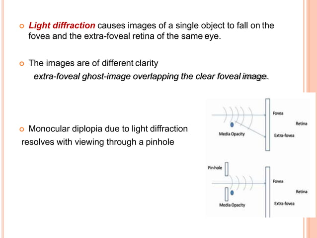 Diplopia approach | PPTX | Eye and Vision Conditions | Diseases and ...