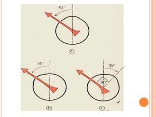 Diplopia approach | PPTX