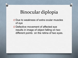 Diplopia by yugandhar tummala | PPTX