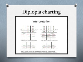 Diplopia by yugandhar tummala | PPTX