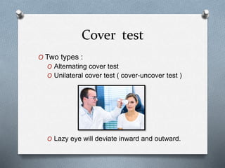 Diplopia by yugandhar tummala | PPTX