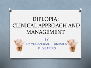 Diplopia by yugandhar tummala | PPT