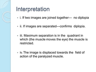 Diplopia chart | PPTX
