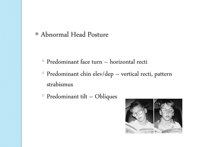 Diplopia chart | PPTX