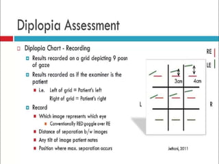 Diplopia chart and its uses | PPTX