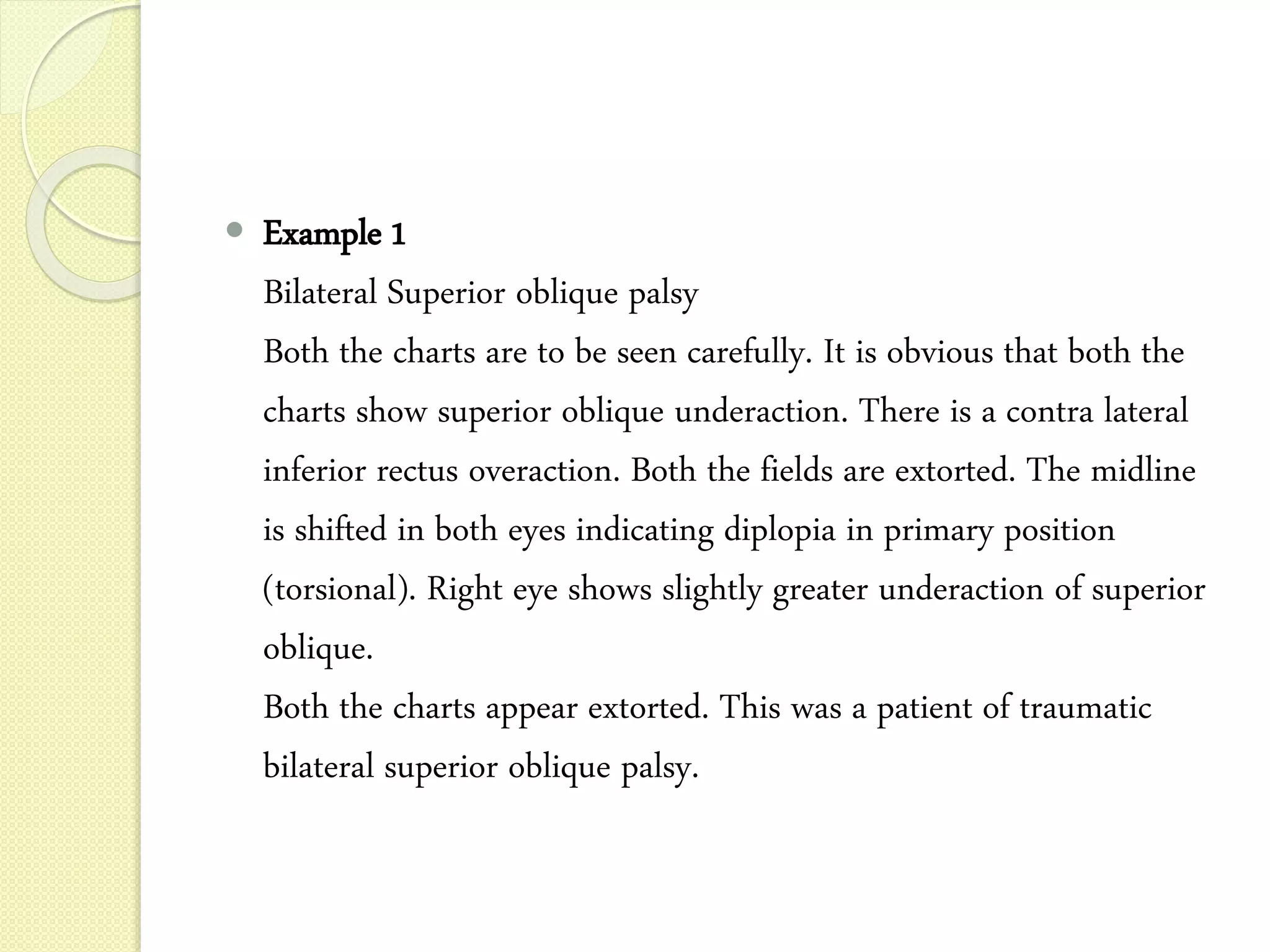 Diplopia charting | PPTX