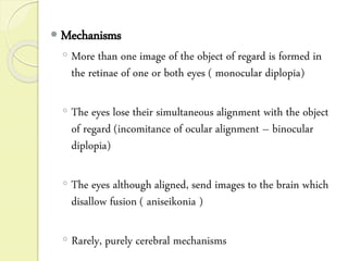 Diplopia charting | PPT