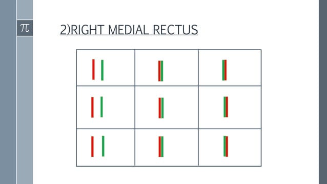 Diplopia charting | PPTX | Eye and Vision Conditions | Diseases and ...