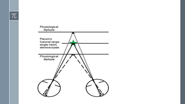 Flow Diagram For Diplopia Referral Diagnostic Criteria Refer