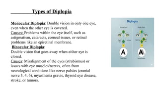 Diplopia charting in Ocular Motility pptx... | PPTX