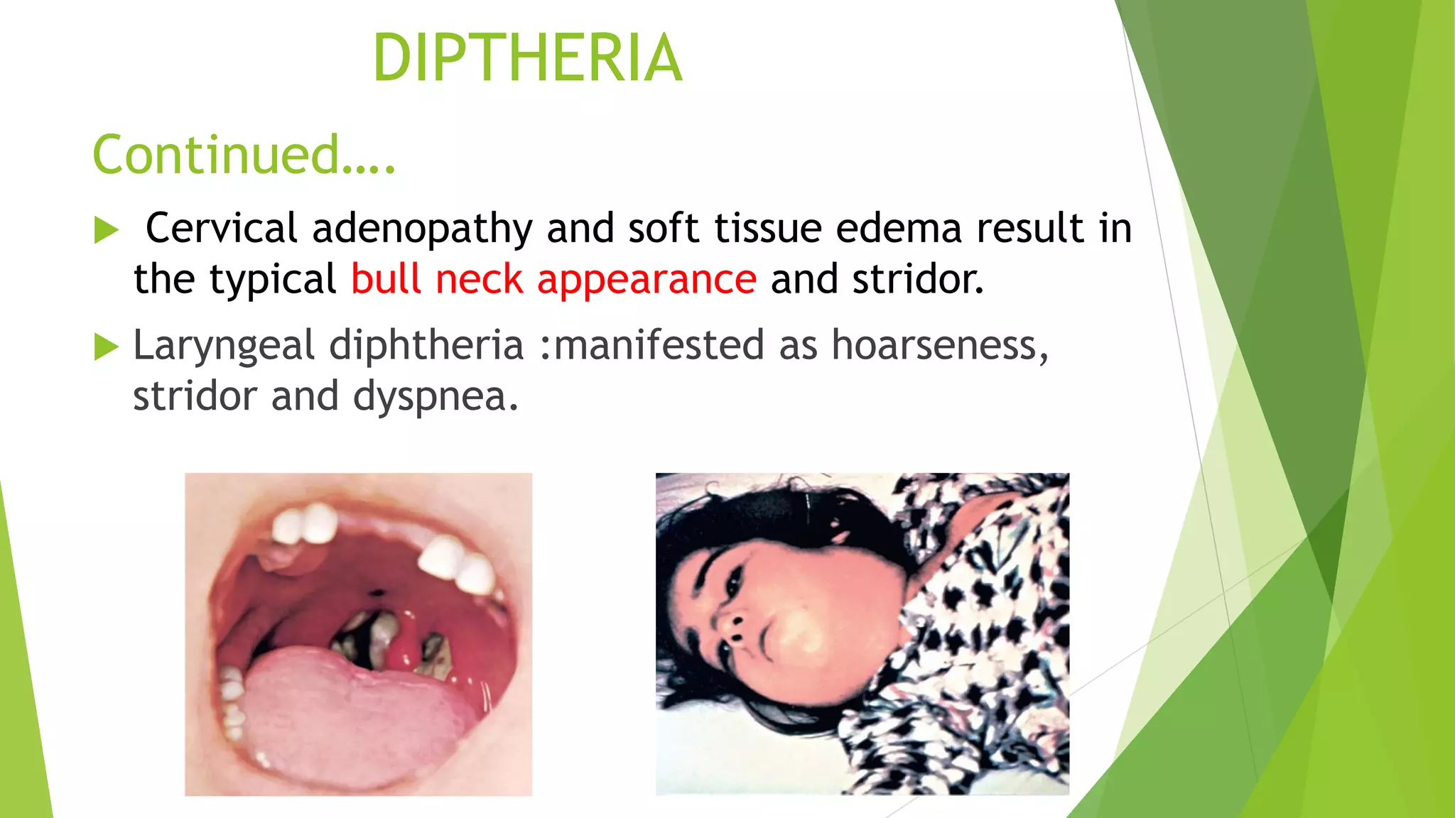 Diptheria ,Pertusis, Tetanus | PDF