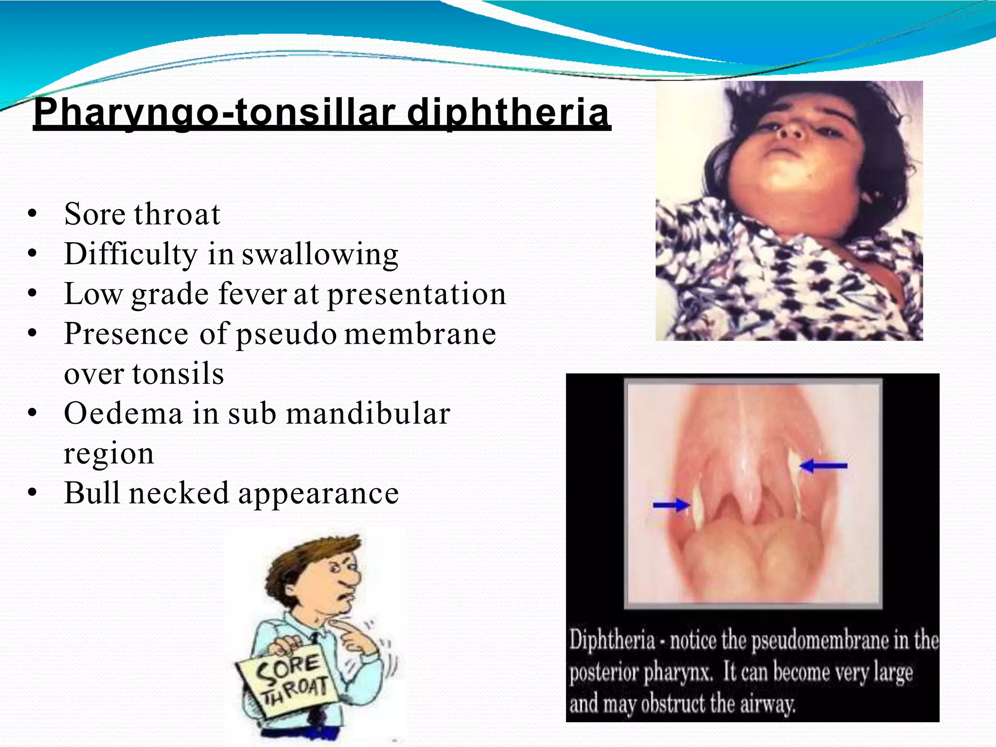 Diptheria Final.pptx